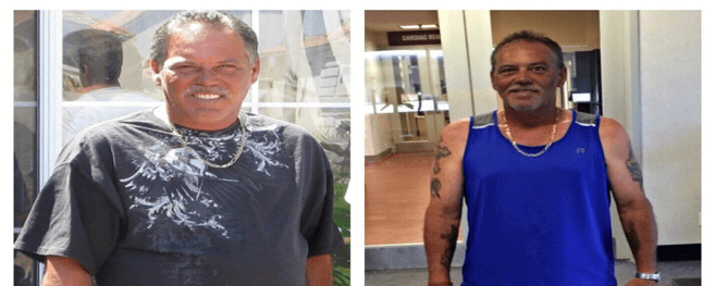 I lost 40 lbs. | Patient Stories